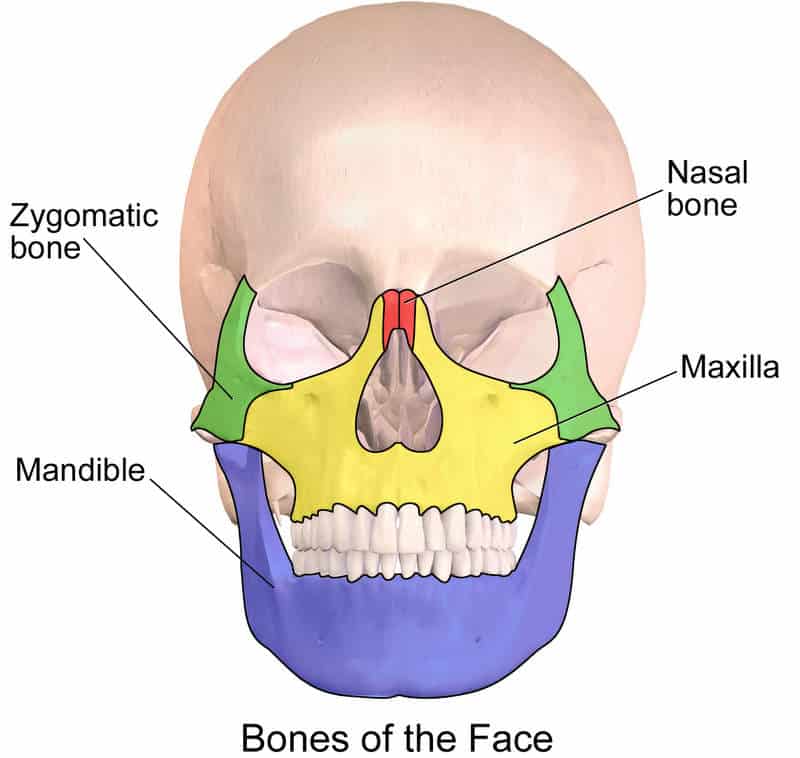 $110,000 Settlement: Orbital (Eye Bone) Fracture in Car Crash